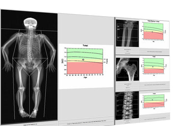 Learn More – DEXA SCAN NEAR ME
